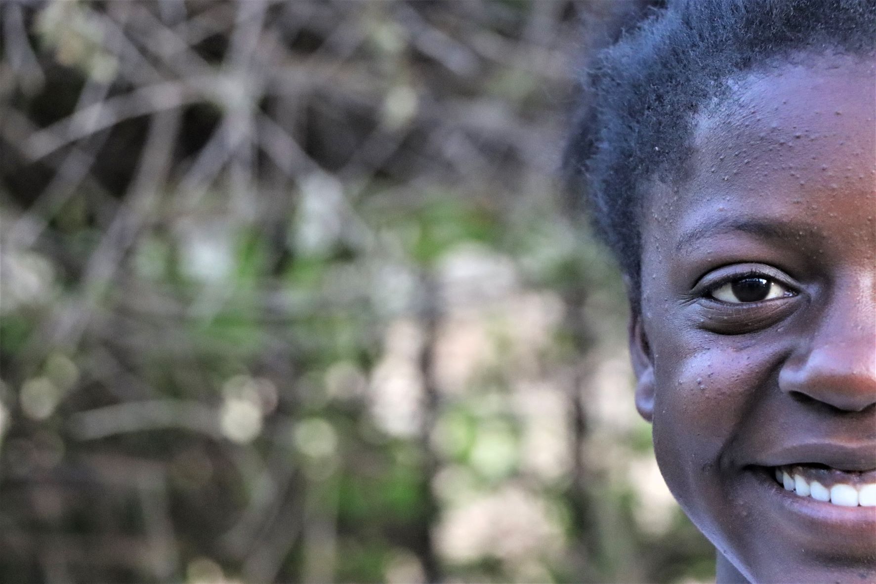 Strong Girls Strong Zambia Campaign | Zambia | World Vision International