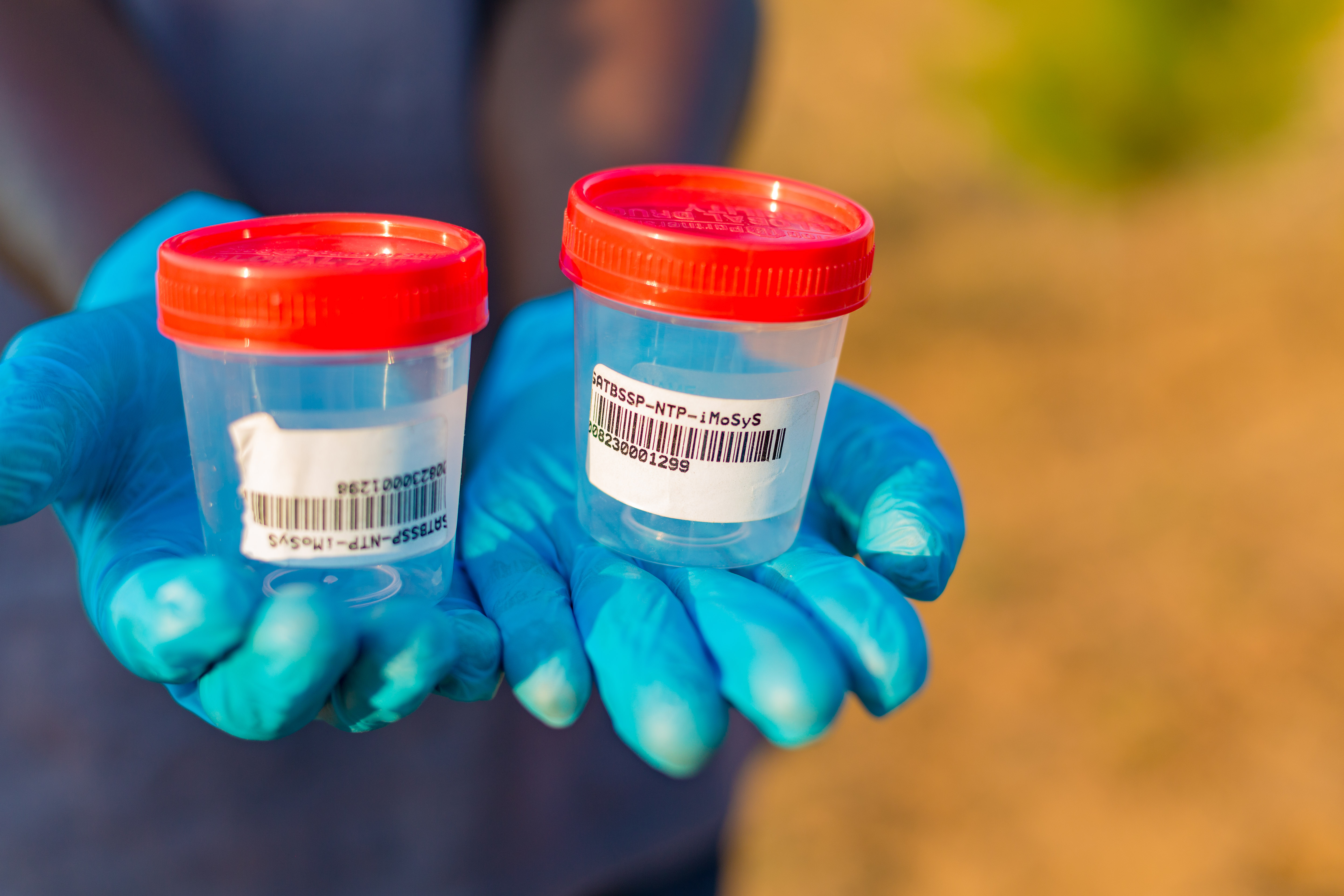 TB Volunteers Transformed Malumbo Jere's Life | Malawi | World Vision ...