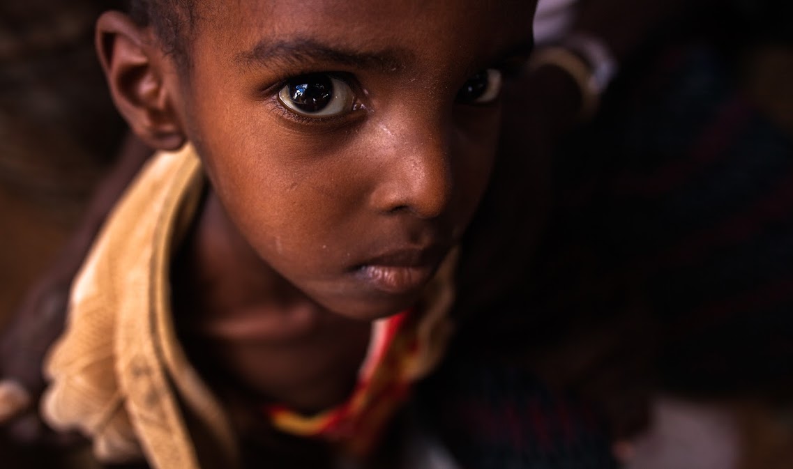 First faces of famine in Somalia | Somalia | World Vision International