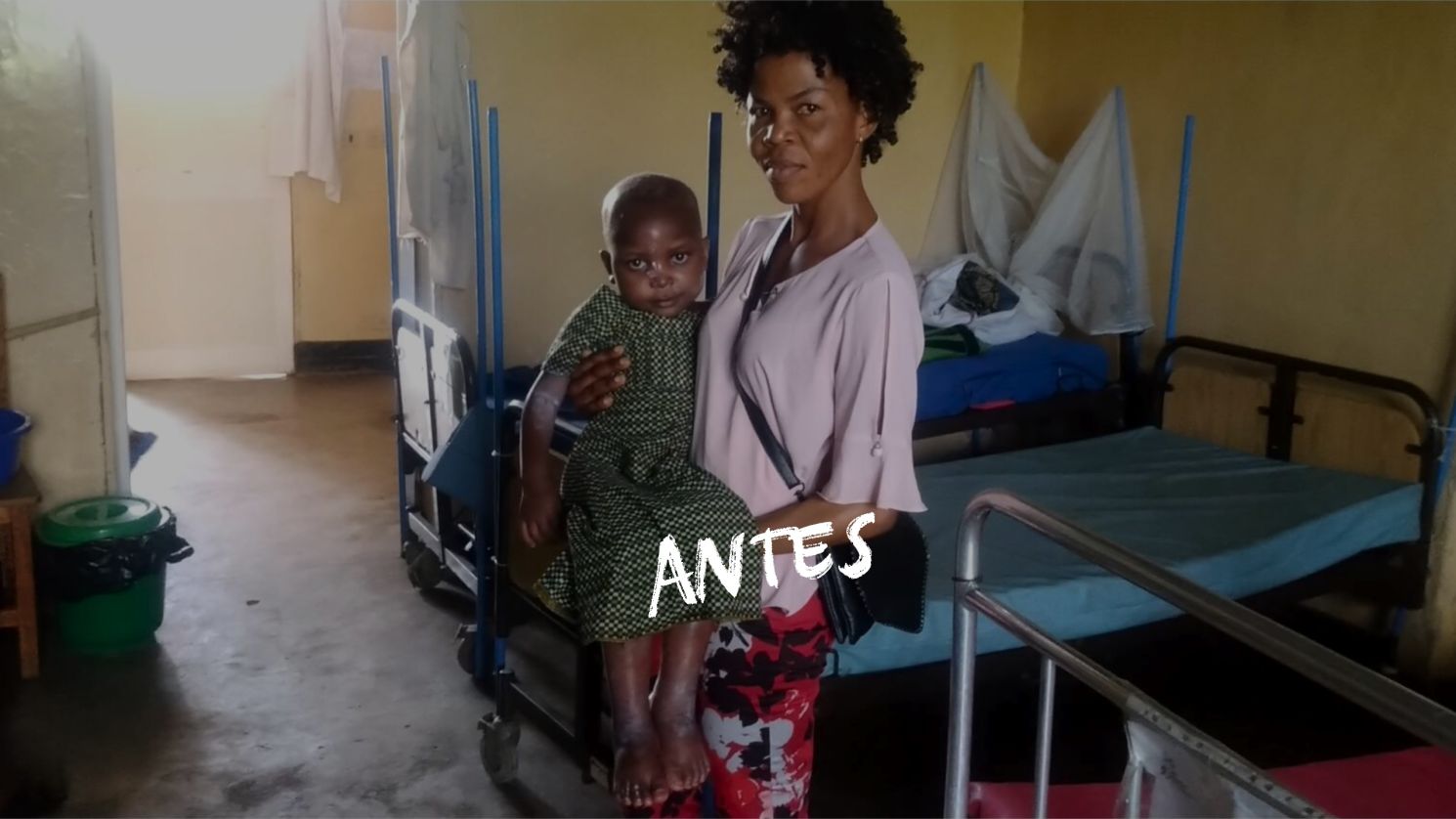 Jusline: Cómo la desnutrición retrasó el sueño de Justine de ir a la ...