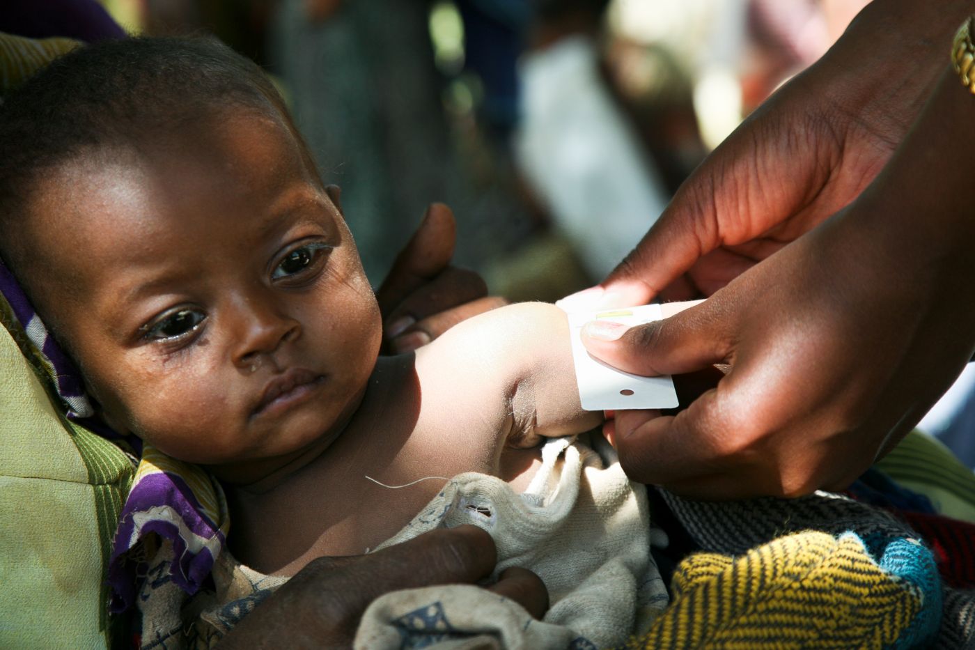 Community-based Management of Acute Malnutrition | World Vision ...