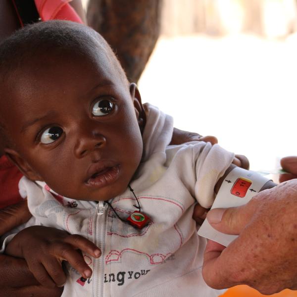 Child Wasting | Nutrition | World Vision International